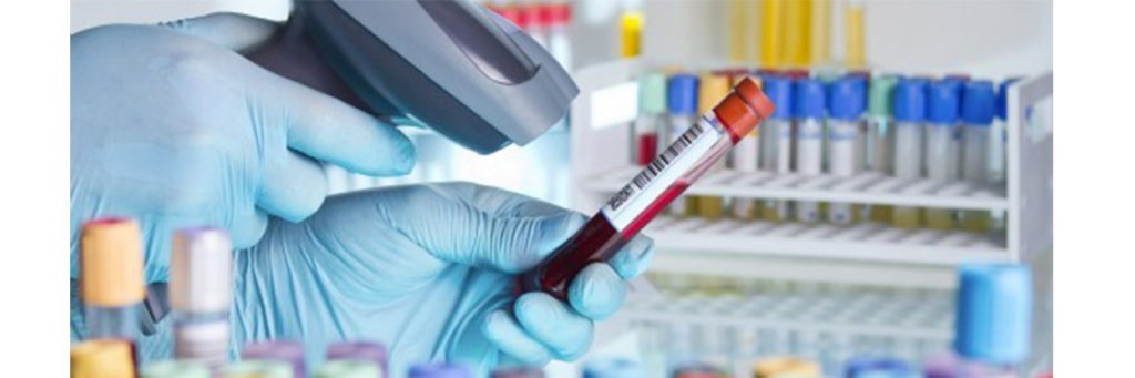 Bilan sanguin : 7 analyses essentielles pour votre santé